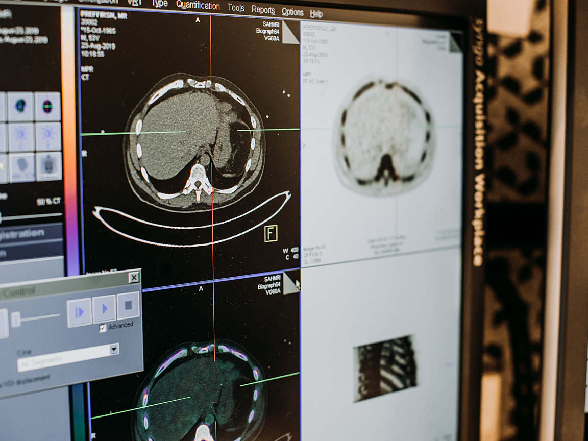 SAHMRI | Australian-first scanner SA at national forefront of imaging ...