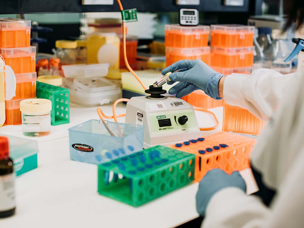 SAHMRI | Prostate Cancer Research Group