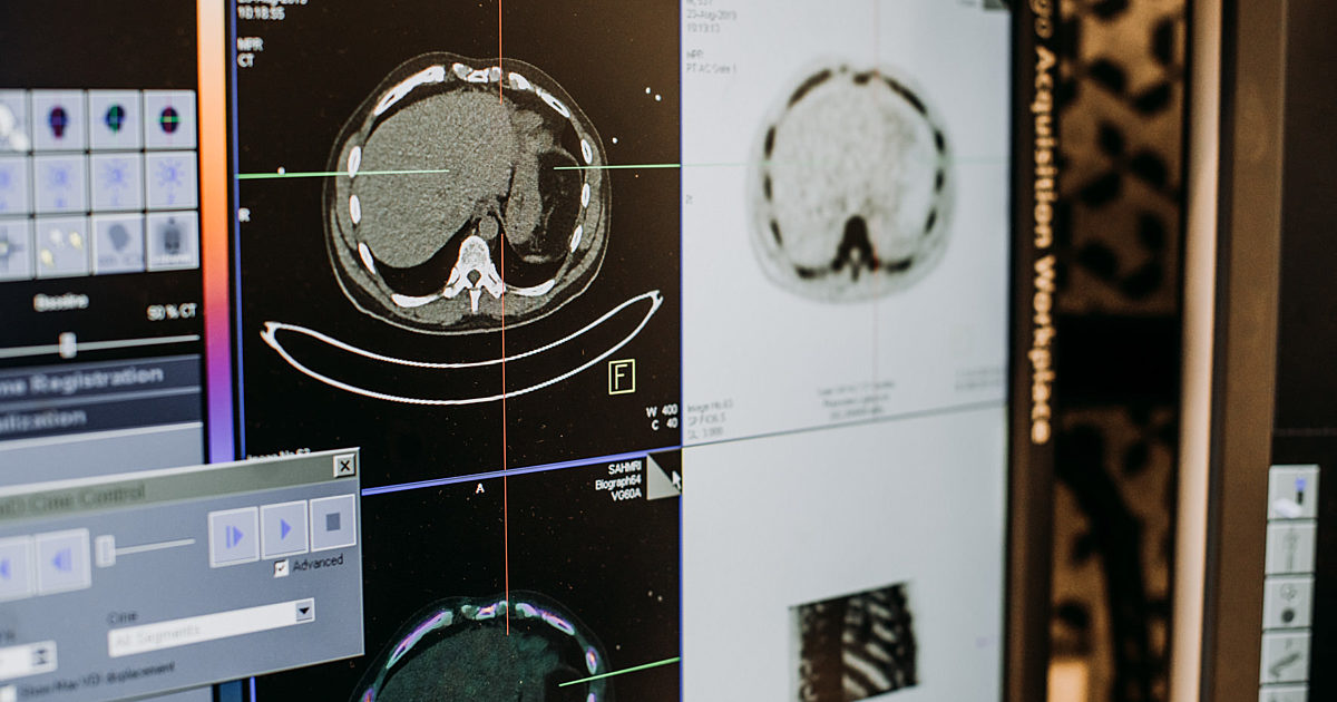 SAHMRI | A game changer for imaging in South Australia