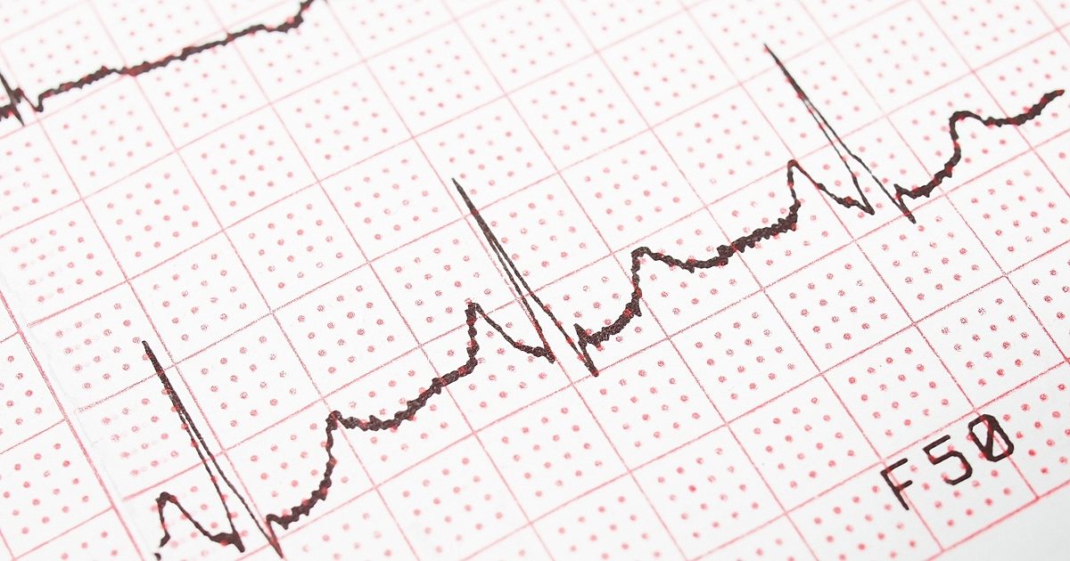 SAHMRI | Cardiovascular specialists unite to tackle the war against…