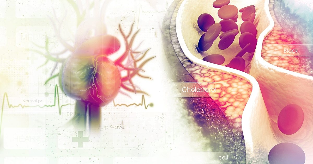 SAHMRI | Bad news for heart disease is good news for high cholesterol