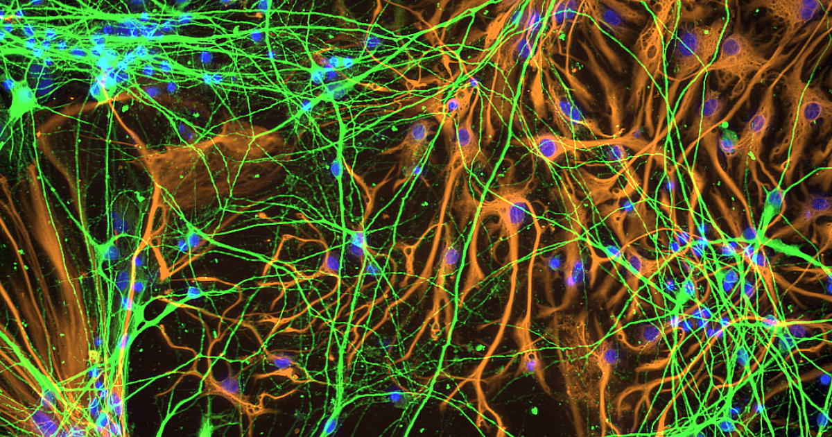SAHMRI | Brain Organoid Therapeutics (BOT)