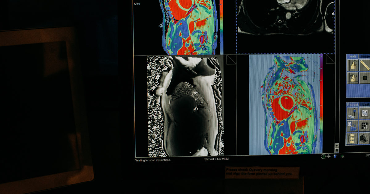 SAHMRI | Cardiac Imaging Research Group