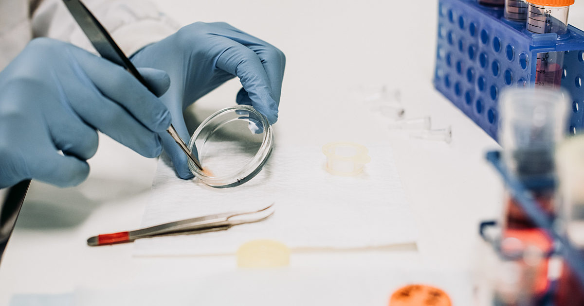 SAHMRI | Laboratory For Human Neurophysiology And Genetics