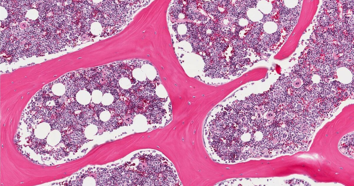 SAHMRI | Building New Bone Marrow From Scratch