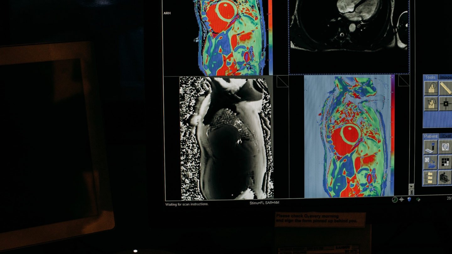SAHMRI | Cardiac Imaging Research Group