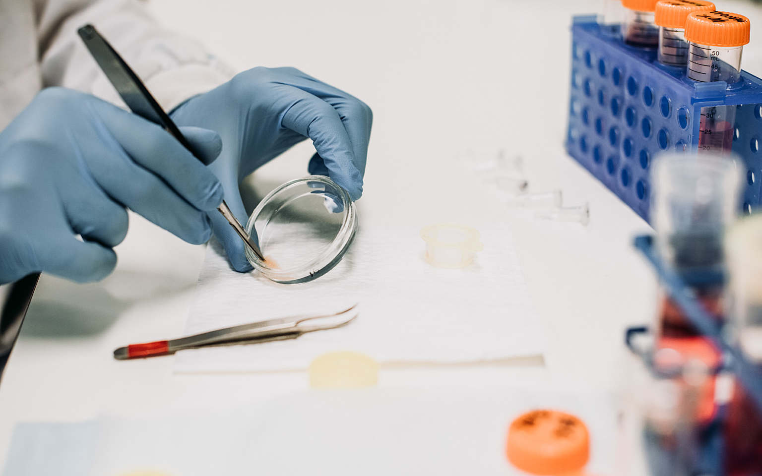 SAHMRI | Laboratory For Human Neurophysiology And Genetics