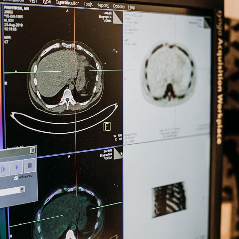SAHMRI | Australian-first scanner SA at national forefront of imaging ...